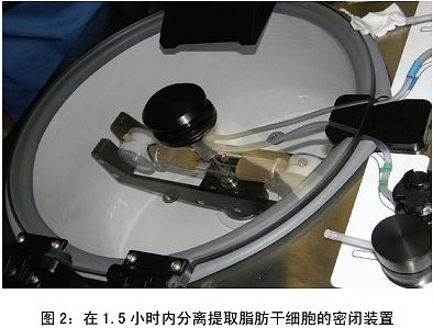 使用Celution系 统（Cytori Therapeutics公司，美国）抽吸脂肪组织，分离获取ADSCs。简单地说... - 雪球