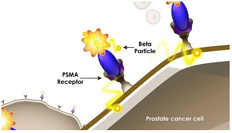 复盘Endocyte公司 老李之前写过两篇文章介绍Endocyte公司（纳斯达克股票代码：ECYT），当时还提醒这家公司马上要凉。结果没过几个 ...