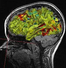 行业｜脑磁图：探索生命禁区的新星！ 前言人的大脑被称为“生命禁区”，科学家们从未停止对它的探索。脑磁图(MEG)是目前最先进的磁源成像技术。脑 ...