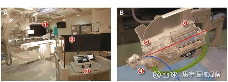 行业｜心脏支架手术泛滥？心血管介入手术机器人能改变这个局面吗？ 前言PCI经皮冠状动脉介入治疗（俗称的心脏支架手术）被视为介入医生的“摇钱树 ...