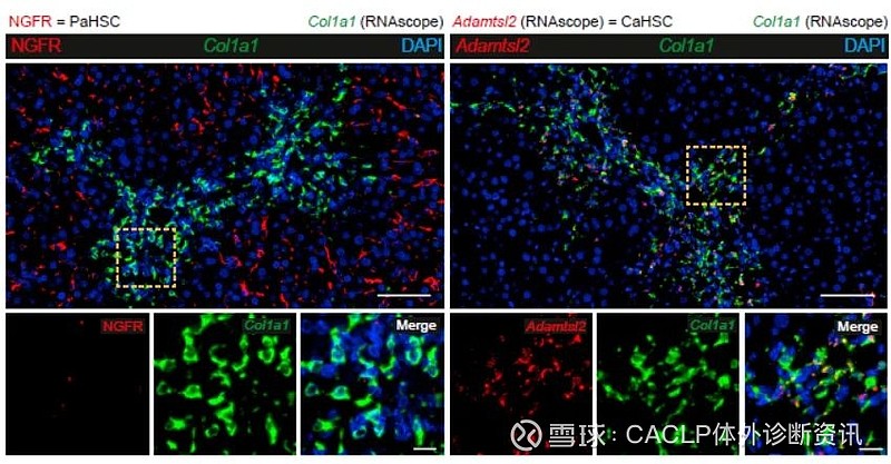 单细胞测序后的RNAscope验证实例——2019年代表性文章解读 单细胞RNA测序（single-cell RNA sequencing ...