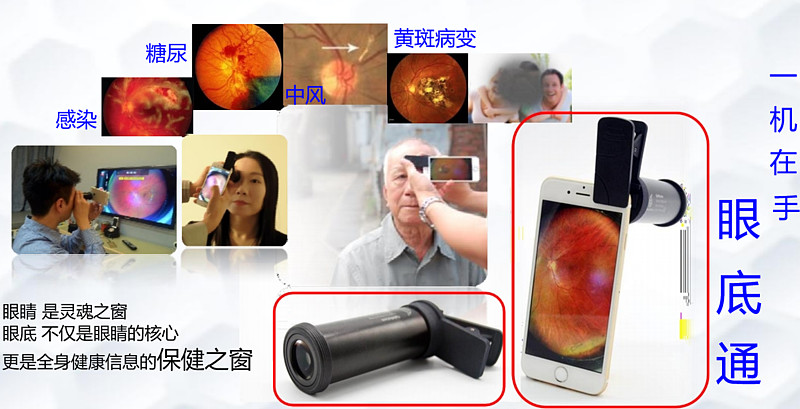 科创希玛（部分公开） 1.BELKIN Laser最终完成总金额为1225万美元的B轮融资，希玛入股8.6%对数以百万计的青光眼患者来说，获得 ...