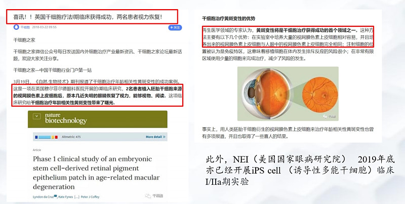 科创希玛（部分公开） 1.BELKIN Laser最终完成总金额为1225万美元的B轮融资，希玛入股8.6%对数以百万计的青光眼患者来说，获得 ...