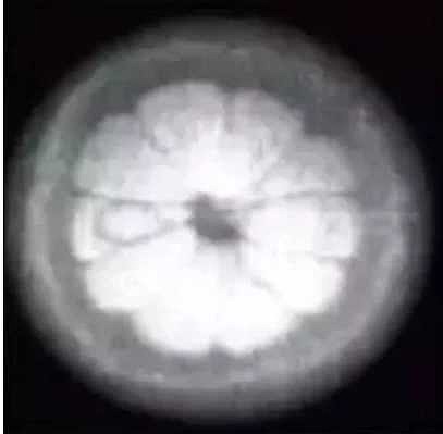 核磁共振成像（MRI）的发展史 核磁共振成像 (NMRI，Nuclear Magnetic Resonance Imaging)，也称磁共振 ...