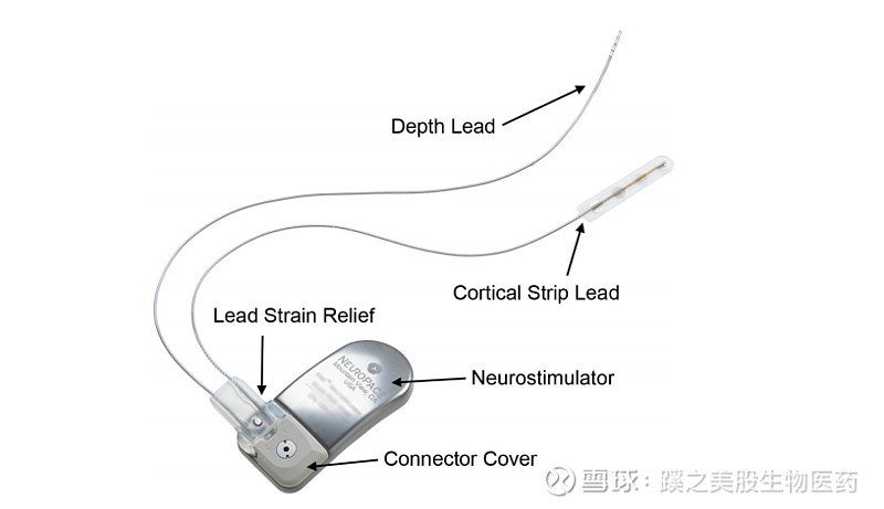 IPO早知道 | NeuroPace: 实时记录、治疗癫痫的植入型神经设备公司申请7500... 作者：Wenjing 微信公众号：蹊之美股 ...