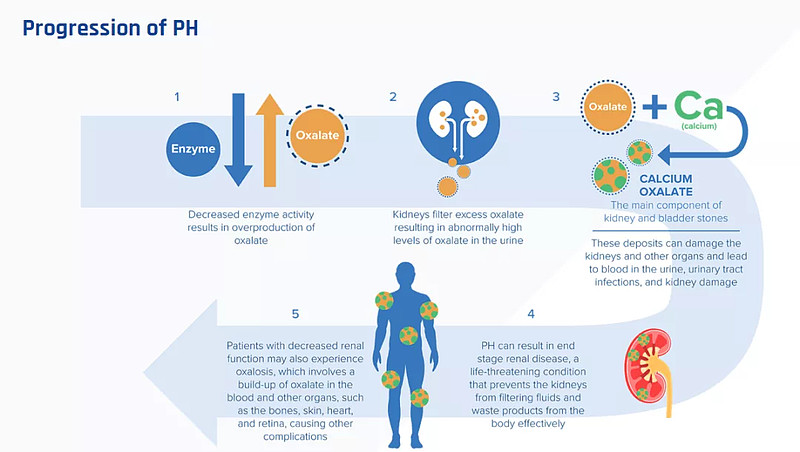 RNAi药物Nedosiran临床出炉，结果喜忧参半 原文链接8月6日专注研究RNAi疗法的公司Dicerna发布了管线基因治疗药物 ...