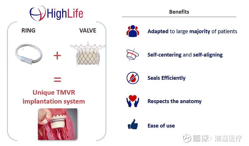 TCT 2021 | HighLife经房间隔入路二尖瓣置换可行性研究结果全球首发，陈茂教授解读经导管二尖瓣置换未来 2021年11月4日~6 ...