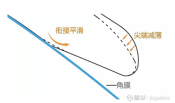 爱博医疗普诺瞳渐进离焦RGP 在近视防控器械领域 $爱博医疗(SH688050)$ 普诺瞳家族已经形成矩阵：OK镜，RGP角膜接触镜和微透镜渐变离焦镜... - 雪球