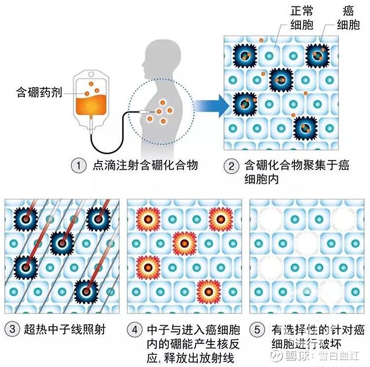 最快30分钟杀死癌细胞 抗癌药BNCT硼药在重庆完成中试 来源：上游新闻-重庆晨报最快30分钟杀死癌细胞，这样的抗癌药在重庆完成中试，具备规模生产的可行性。11月23日，上游新闻... - 雪球