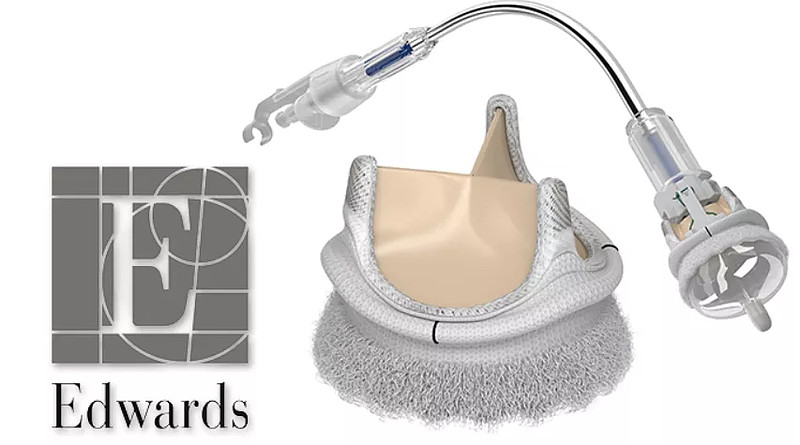 国内唯一获批！免缝合生物主动脉瓣完成首例手术 来源：器械之家，未经授权不得以任何形式转载，且24小时后方可转载。2022年1月12日，英国心脏 ...