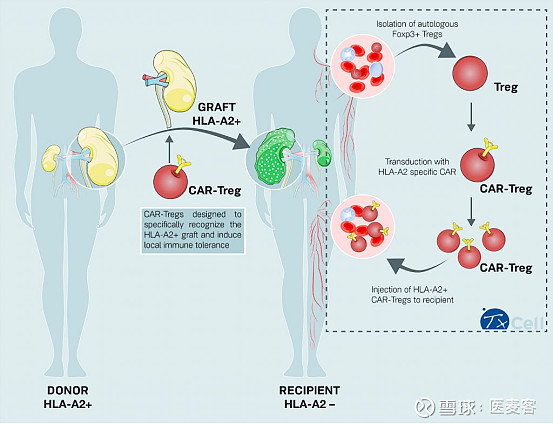 细胞免疫治疗的又一前沿进展：首个CAR-Treg疗法已进行患者给药丨医麦猛爆料 2022年3月31日/医麦客新闻 eMedClub News ...