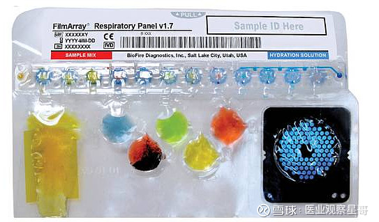 FilmArray脑膜炎14联检获批，独家起底脑膜炎/血流感染分子市场 点击关注我们 有观点，有态度 这是医业观察的第1502-4期文章 作者 ...