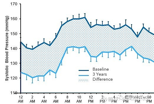 美敦力一波三折的RDN探索之路 文章来源：思宇 MedTech ；编辑： lulu 转载要求：首发24小时后可转载，需注明来源 作为一个年收入 ...