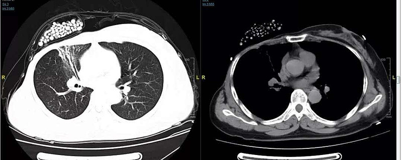 德喜曲妥珠单抗ENHERTU(DS-8201)中国香港已上市中文说明书 DS-8201，通用名：Fam ...