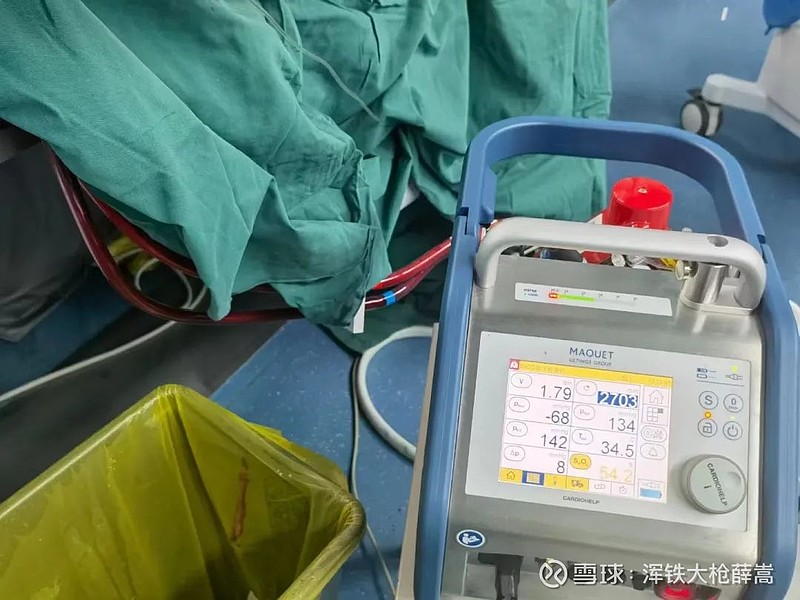 安徽首例 安徽首例ECMO支持下TAVR手术！中国科学技术大学附属第一医院徐健教授团队成功挽救患者生命：多学科协作，共克难关原创 ... - 雪球