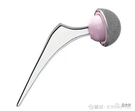 一文了解如何选择合适的髋关节假体 文章来源：骨未来 ；编辑：Jacky 转载要求：首发24小时后可转载，需注明来源 髋关节假体是一种可植入式 ...