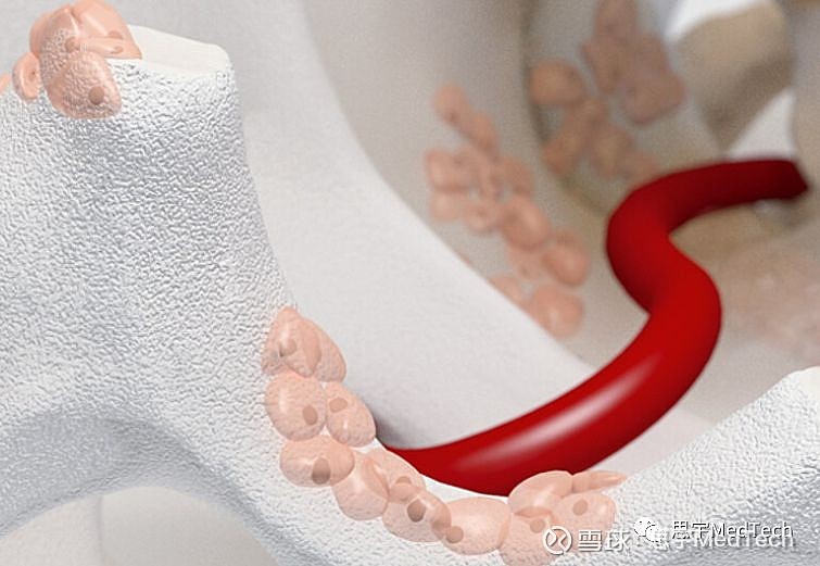 骨再生大咖：瑞士盖氏的故事 文章来源：思宇 MedTech ；编辑：白晓菲 转载要求：首发24小时后可转载，需注明来源 再生医学指对人体细胞 ...