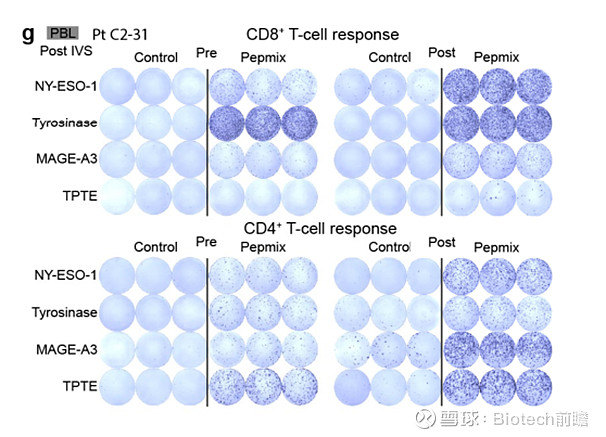 mRNA肿瘤疫苗联用PD-(L)1单抗，2b期研究成功 PD-(L)1单抗因患者响应率低和耐药问题，一方面开始向双抗和多抗进行技术迭代；另一 ...