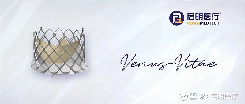 国际化新进展！新一代球扩干瓣Venus-Vitae®于阿根廷获批上市 NEWS近日， 启明医疗 自主研发的新一代球扩干瓣Venus-Vitae ...