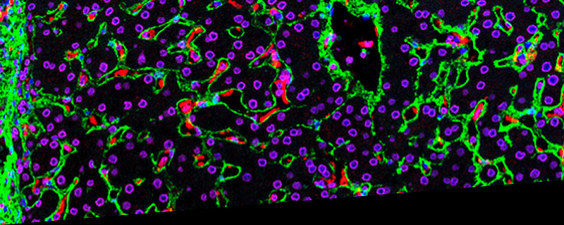 多重组化助力癌症研究及临床应用转化新进展（含mIHC抗体验证列表）| 大咖讲座 来源：小桔灯网近期火热的多重组化（mIHC）是由检测单一靶标的 ...