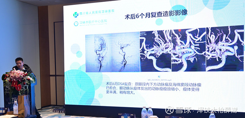 Tubridge®密网支架Trace-lA临床研究中期分析结果优于国外DIVERSION临床研究结果 $微创脑科学(02172)$ 上海长海医院李强教授向大家解读了Tubridge®血流导向密 ...