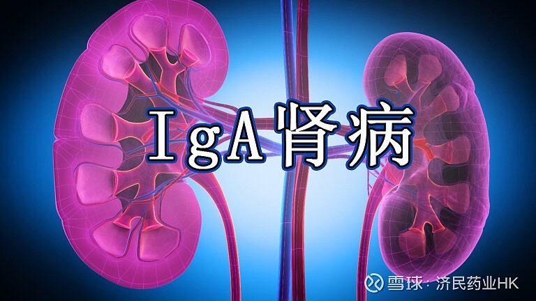 第二种降低IgA肾病蛋白尿新药！FDA加速批准Filspari(sparsentan) 原发性免疫球蛋白A肾病(IgA肾病)是一种由于肾脏中与 ...