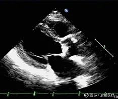 评价完美 | 启明医疗Venus-PowerX®于CRT2023成功完成全球首次手术直播 2月27日，杭州启明医疗器械股份有限公司（“ 启明 ...