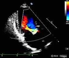评价完美 | 启明医疗Venus-PowerX®于CRT2023成功完成全球首次手术直播 2月27日，杭州启明医疗器械股份有限公司（“ 启明 ...