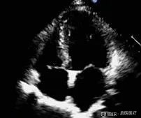 评价完美 | 启明医疗Venus-PowerX®于CRT2023成功完成全球首次手术直播 2月27日，杭州启明医疗器械股份有限公司（“ 启明 ...