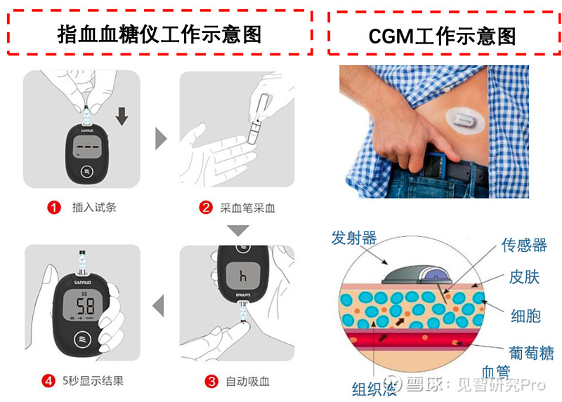 苹果将颠覆的血糖监测市场，现状如何？ 苹果 的一条无创连续血糖监测技术获得突破的消息，为什么让全球市场为之震动？简单说，它解决糖尿病人的两个