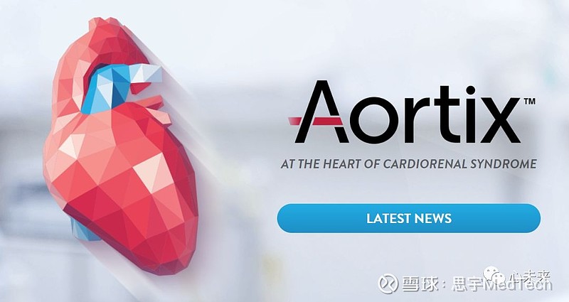 突破！介入泵降低心脏手术急性肾损伤 文章来源：心未来 ；编辑： lulu 转载要求：请在文首标明文章来源，可直接转载近期，Procyrion ...