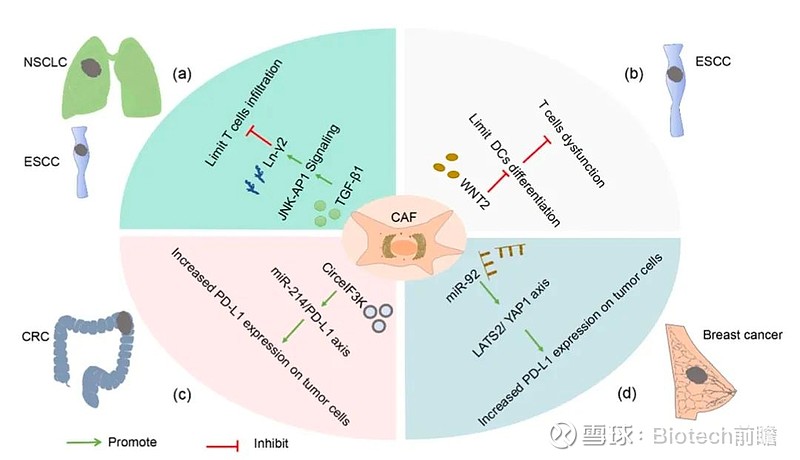 肿瘤相关成纤维细胞(cafs)在实体瘤pd 1 Pd L1单抗免疫治疗中的作用 ——摘 要——近年来,肿瘤免疫治疗取得了突破。然而,肿瘤免疫