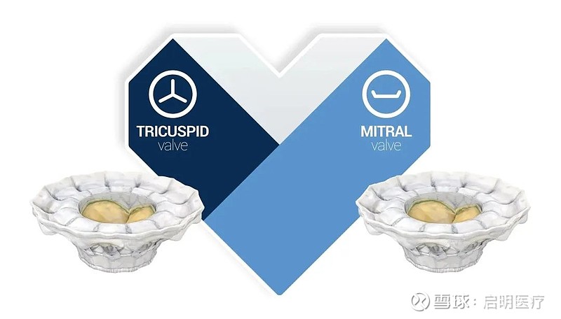 美国首例！Cardiovalve三尖瓣置换国际临床再迎突破 Cardiovalve 3月8日，杭州启明医疗器械股份有限公司（“ 启明医疗 ...