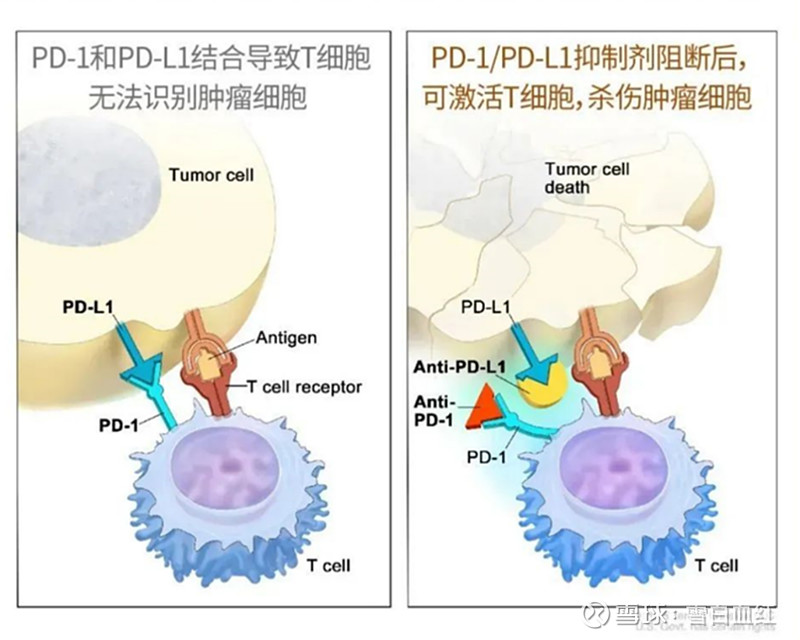 PD-L1与PD-1有何不同？ 医世象 抗体圈 2023-04-12 06:48 发表于湖北 网页链接目前国内免疫药物主要有PD-1单抗和PD-L1单抗... - 雪球