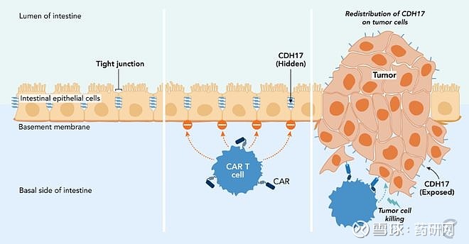 消化道肿瘤靶点新星：CDH17 Cadherins是一个大型的细胞粘附分子超家族，至少有六个亚家族，包括典型Cadherin、非典型 ...