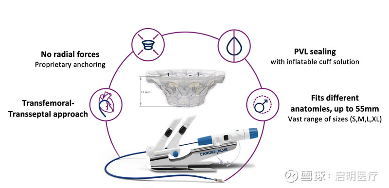 30例突破！| Cardiovalve TARGET CE研究覆盖十大国际知名心血管中心 Cardiovalve近日，在德国巴特恩豪森的波鸿鲁 ...