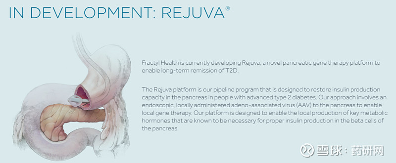 对比司美格鲁肽：GLP1一次性基因疗法临床前展现优异降糖/减重效果 6月24日， Fractyl Health 公布了其一次性GLP-1胰腺 ...