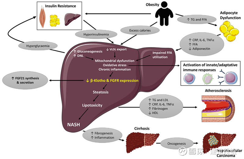 第5期 NASH及治疗药物（一） 我司每1-2周就一个药物、疾病、靶点小专题进行专题研究，近期准备把前期研究的内容简化整理一下，做成科普内容 ...