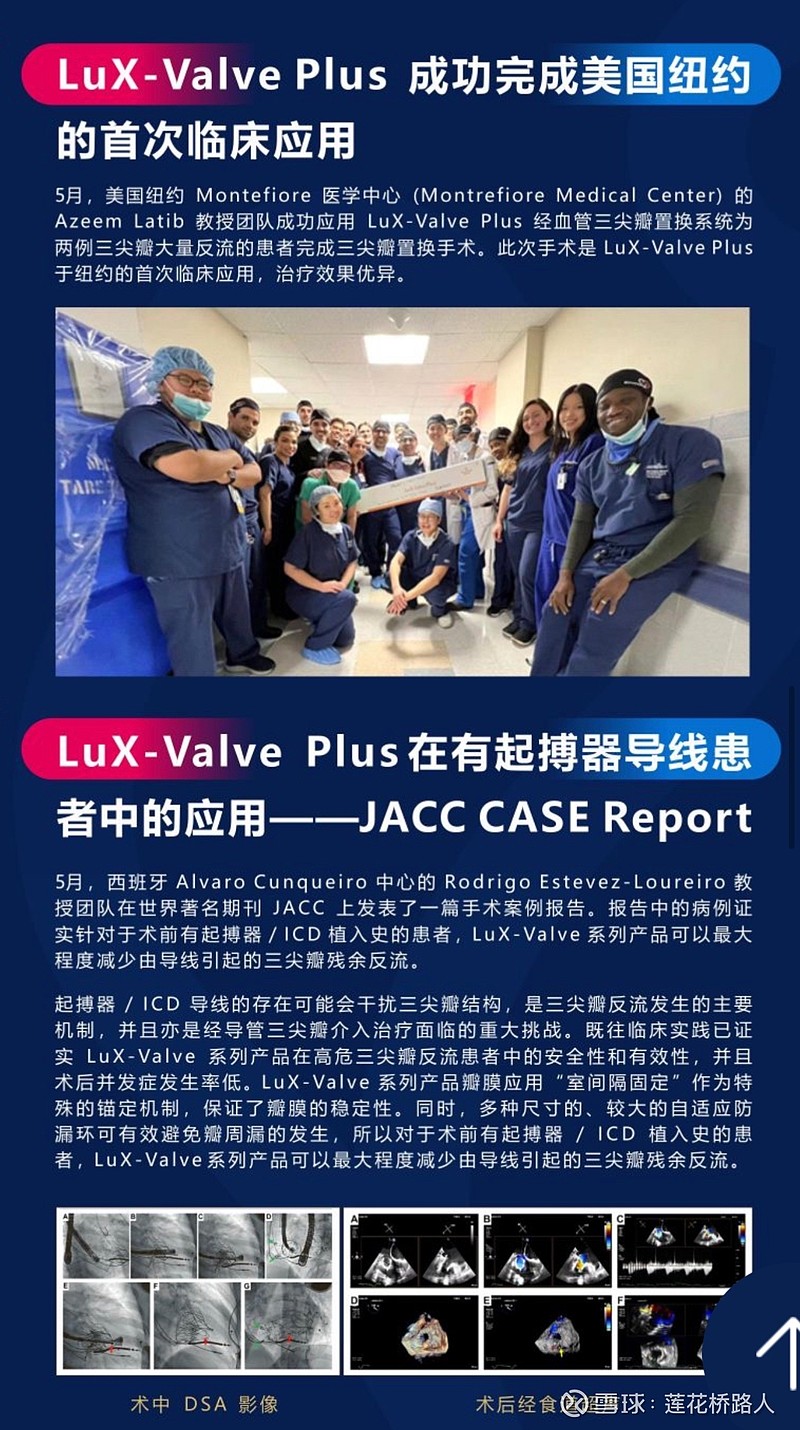 三尖瓣 $健世科技-B(09877)$ 全球临床进展很好。哪位知道下半年Lux-value什么时候可以获批？看股价的反应，应该是... - 雪球