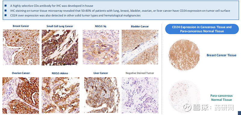 “别吃我”靶点：CD24单抗首次在华申报临床 7月27日，CDE官网显示， 宜明昂科 的CD24单抗药物IMM47已申报临床并获受理。这是国内首个在华申报临床的CD2... - 雪球