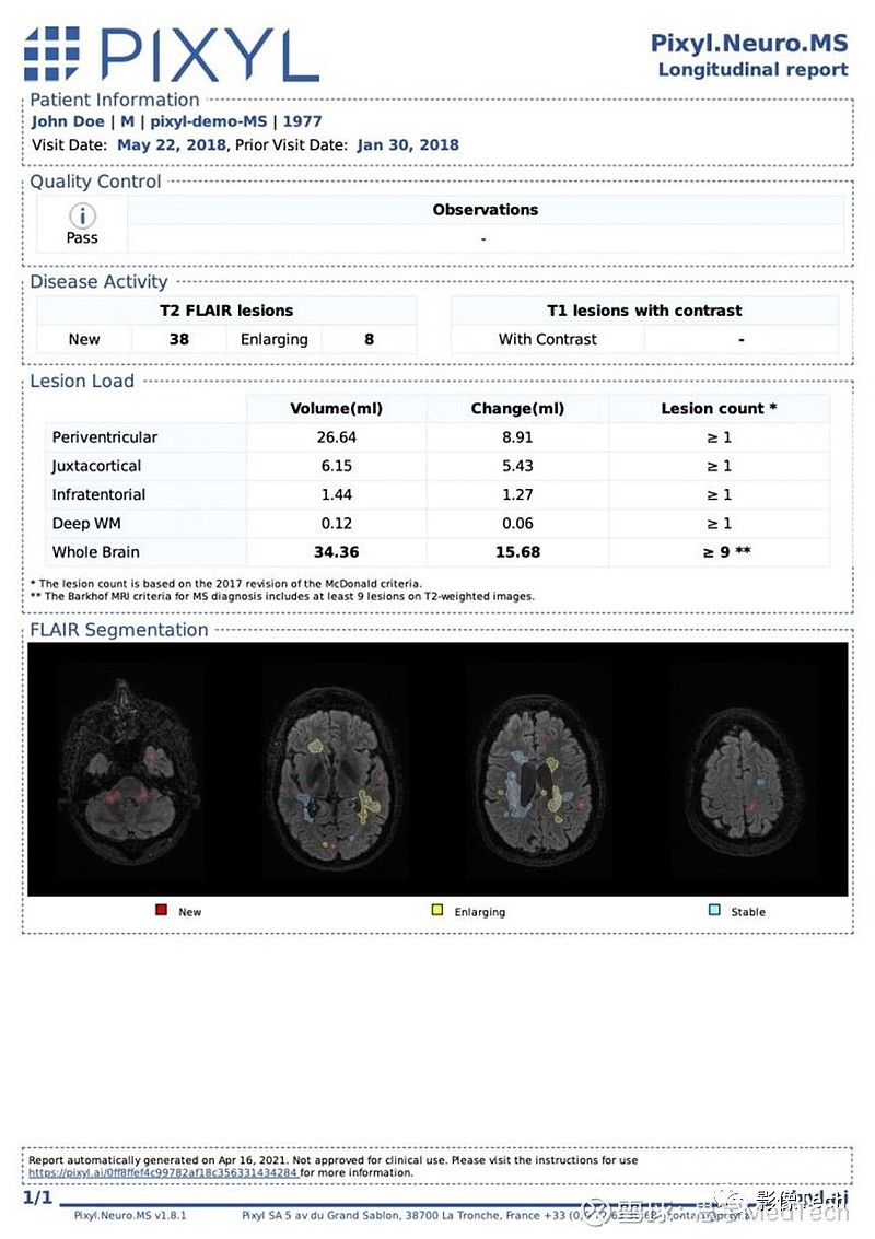 Pixyl：头部MRI分析AI软件获批FDA！ 文章来源：影像Tech ；编辑：刘昕怡转载要求：请在文首标明文章来源，可直接转载2023年11 ...