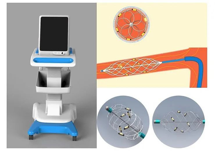 十面埋伏：美敦力的新挑战！ 近期，全球第一、第二款RDN系统获FDA批准一度在行业内引起热烈反响，它们分别是11月7日获批的Recor ...