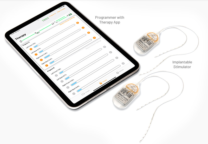 全球首个偏头痛器械，完成首例植入 12月20日， ShiraTronics宣布其慢性偏头痛治疗系统成功植入全球首批6名患者。据了解，该设备也是 ...