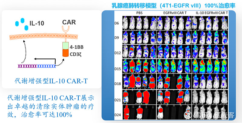 莱芒生物免疫代谢重编程技术解决CAR-T细胞耗竭难题 2023年1月6日/医麦客新闻 eMedClub News/--新年伊始，莱芒生物创始团队的自分泌IL-10 CAR-T... - 雪球