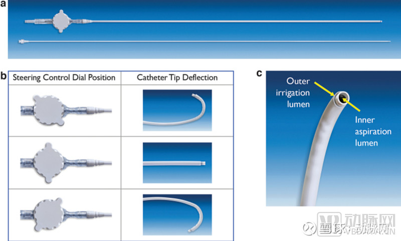 3.5亿融资！Calyxo的CVAC系统让结石清除率达96.1% 肾脏是两个豆状的器官，可以过滤血液中的废物和多余的水分以产生尿液。当尿液中的 ...