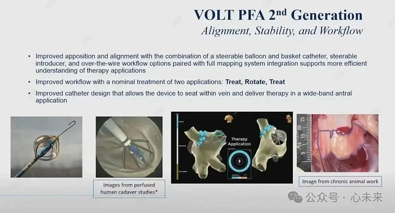 首批人体实验！雅培进军脉冲电场消融 心未来2024年1月19日， 雅培 （纽约证券交易所代码：ABT）宣布公司旗下的新型Volt™脉冲电场消融 ...