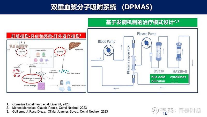 “2024人工肝及血液净化技术示范中心高质量发展学术会议” 彭亮教授：新型人工肝DPMAS组合方案治疗肝衰竭及相关进展人工肝技术发展日新月异 ...