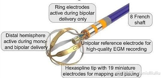 $微电生理-U(SH688351)$ FARAFLEX：波科全新大局灶PFA消融导管 | 适用室性心动过速自从2021年... - 雪球