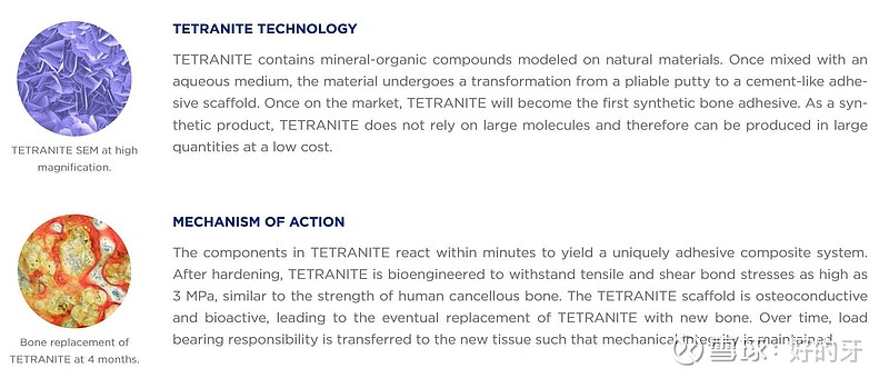 RevBio启动新型骨粘合剂关键性临床试验，有望省去骨移植手术 图源：RevBio近日，美国生物材料研发公司RevBio宣布，其用于牙科种植体 ...