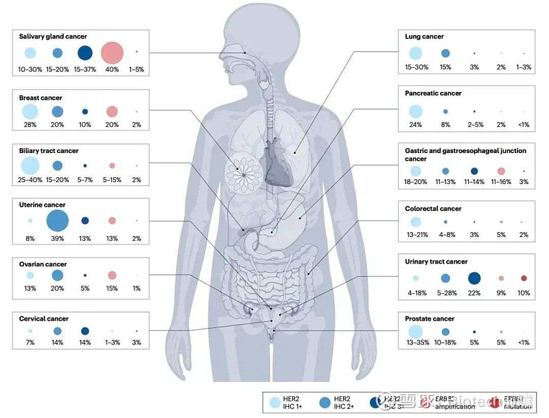 2025CSCO胃癌指南丨Her2表达的临床新定义，从两分类到四分类 添加图片注释，不超过 140 字（可选）添加图片注释，不超过 140 字（可选）Her2 (人表皮生长因子受体2) 是重 ...